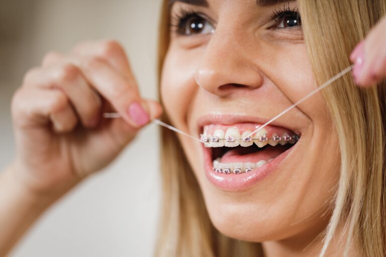 5 Helpful Tips for Flossing with Braces | Simply Orthodontics - CT
